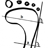 Postural stability, body weight distribution, and foot typology of ...