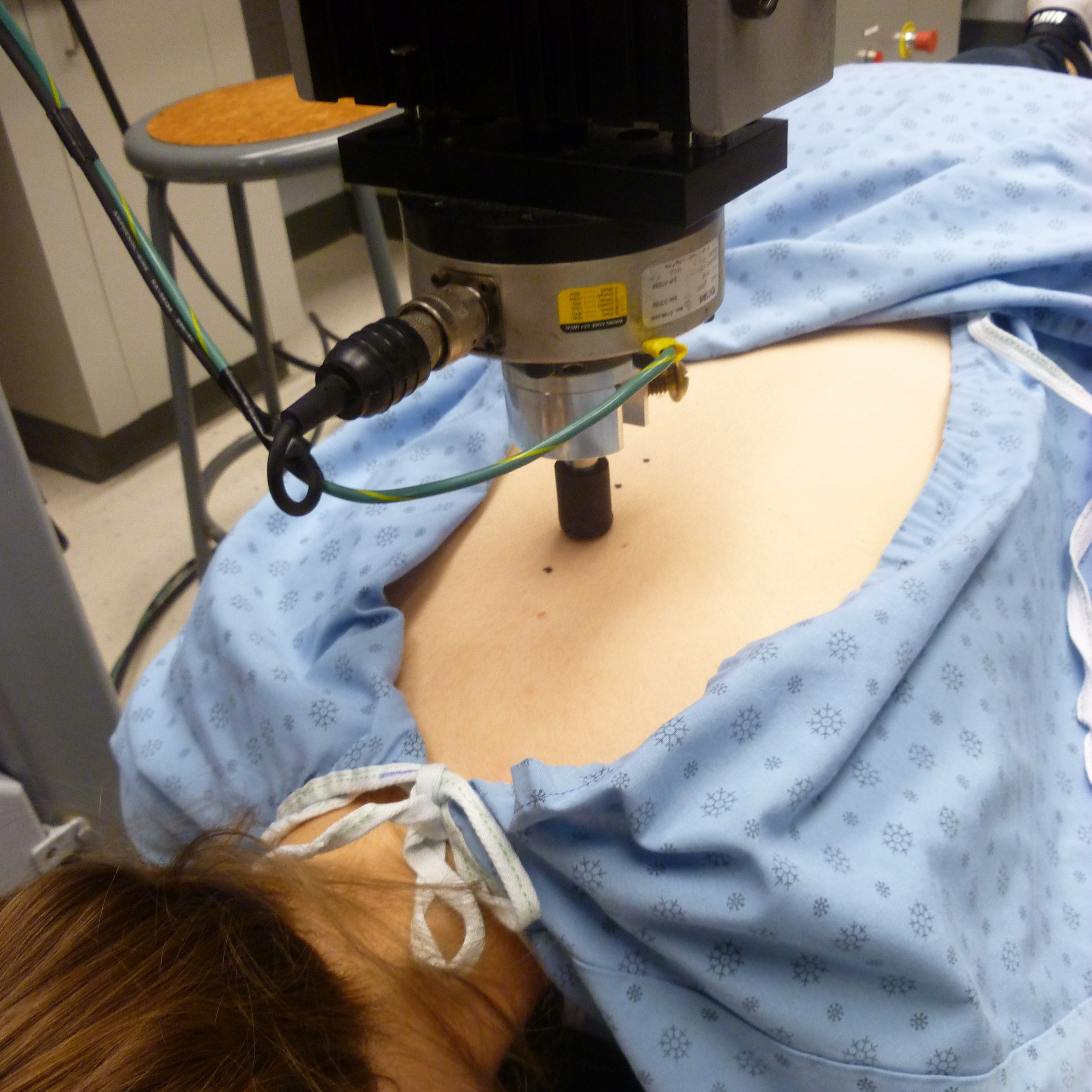 Changes in spinal stiffness with chronic thoracic pain: correlation ...