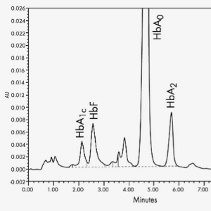 HPLC sample prep