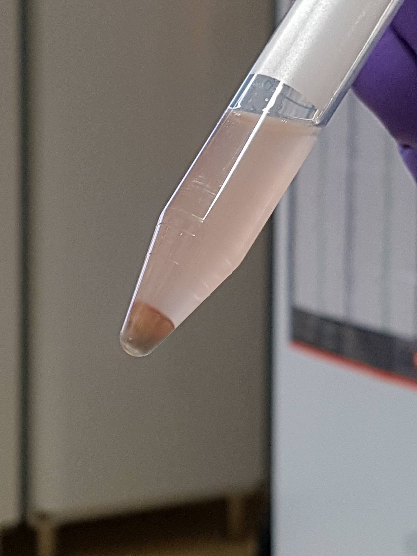 Cell dissociation of fresh human lung tissue for single-cell RNA-seq