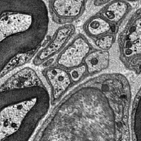 Intracardiac perfusion with fixative for ultrastructural ...