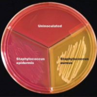 Staphylococcus Aureus Sampling