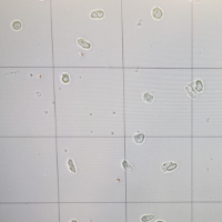 Nuclear extraction from endometrial tumors for single nuclei sequencing