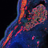 Immunofluorescent staining of formalin-fixed OCT-embedded human lung tissue