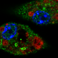 LRRK2 Immunofluorescent staining