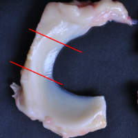 Human Knee Meniscus Collection Protocol for scRNA-seq