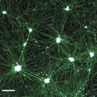 iNIL/iNIP transcription factor-induced motor neuron differentiation v2 ...