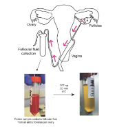 Human Follicular Fluid Procurement and Processing