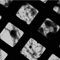 Neural differentiation on EM grids - iNeurons sample preparation for ...