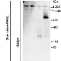 Blue native-PAGE of protein complexes in plant cells