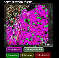 Kidney Functional Tissue Unit (FTU) Segmentation