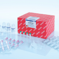 DNA/RNA extraction from fresh-frozen tissue, AllPrep DNA/RNA/miRNA ...