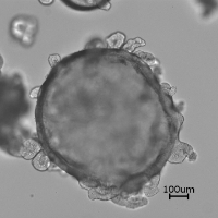 Working with patient-derived enteroids and colonoids