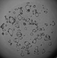 Establishment of patient-derived enteroids/colonoids from endoscopic ...