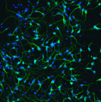 Immunocytochemistry for the characterization of hiPSC to Motor Neuron ...