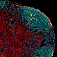 Comparison of Multiple Snap Freezing Protocols and Description of ...