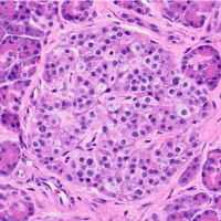 Hematoxylin and Eosin (H&E) Staining for Human Pancreas