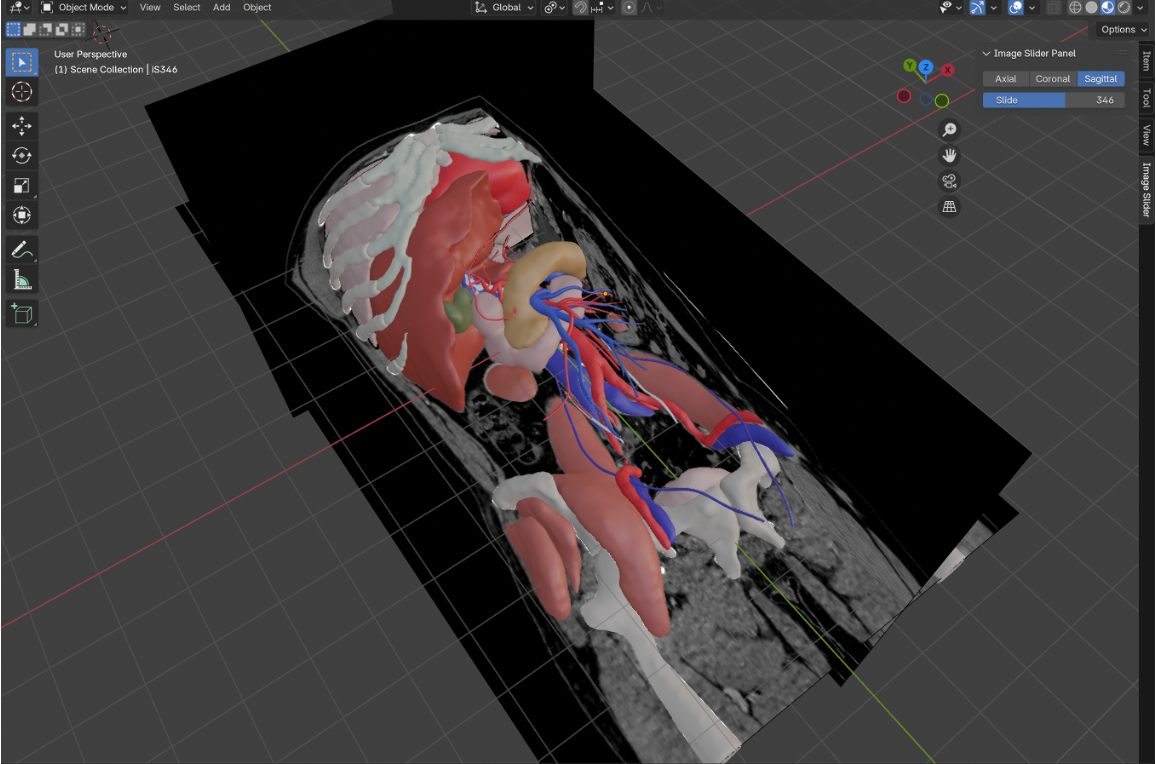 Accurate Digital Organ Models from DICOM