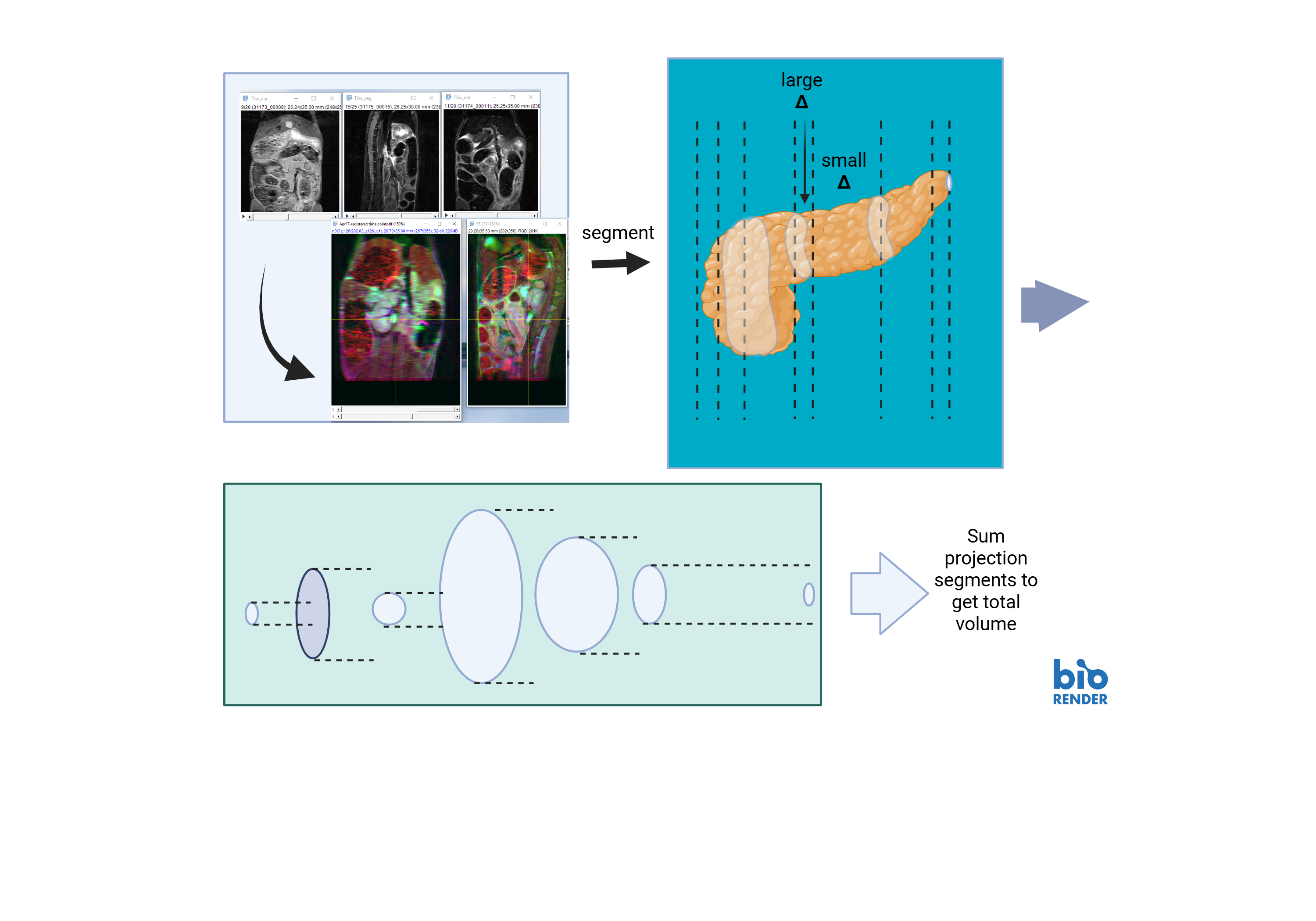 Merge multiple 2D MRI datasets as multichannel stacks via ImageJ & Analyze Pancreas Size