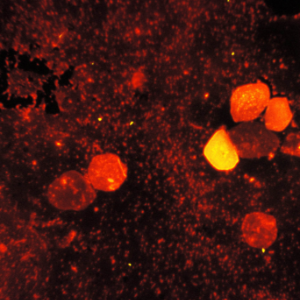 Acridine Orange Staining