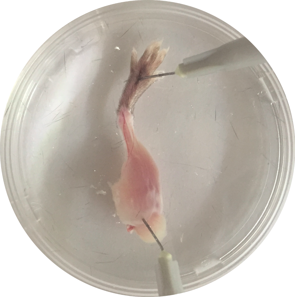 Dissection of mouse EDL and Soleus muscles