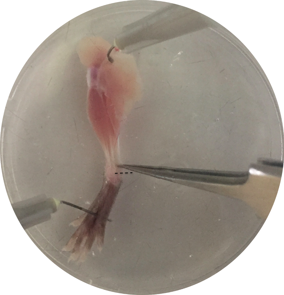 Dissection of mouse EDL and Soleus muscles