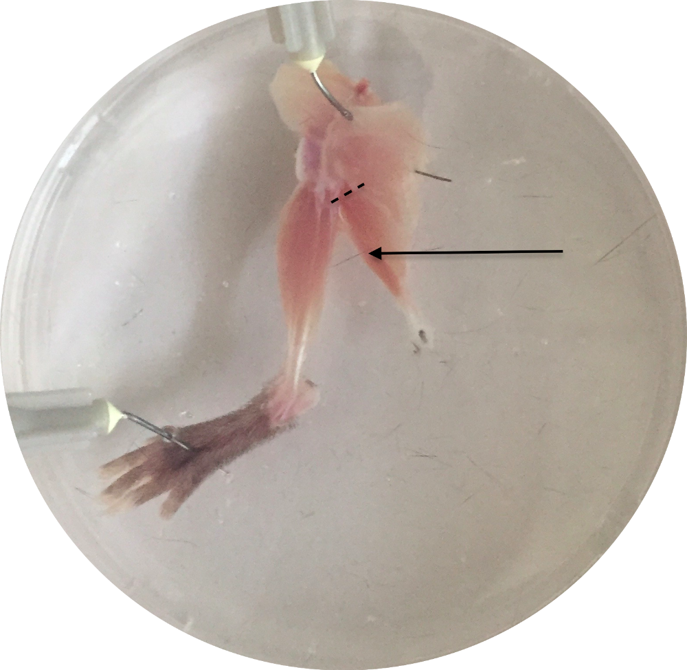Dissection of mouse EDL and Soleus muscles