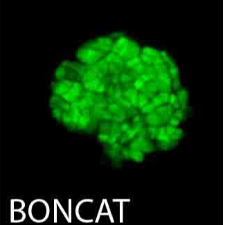 Detection of protein-synthesizing microorganisms in the environment via ...