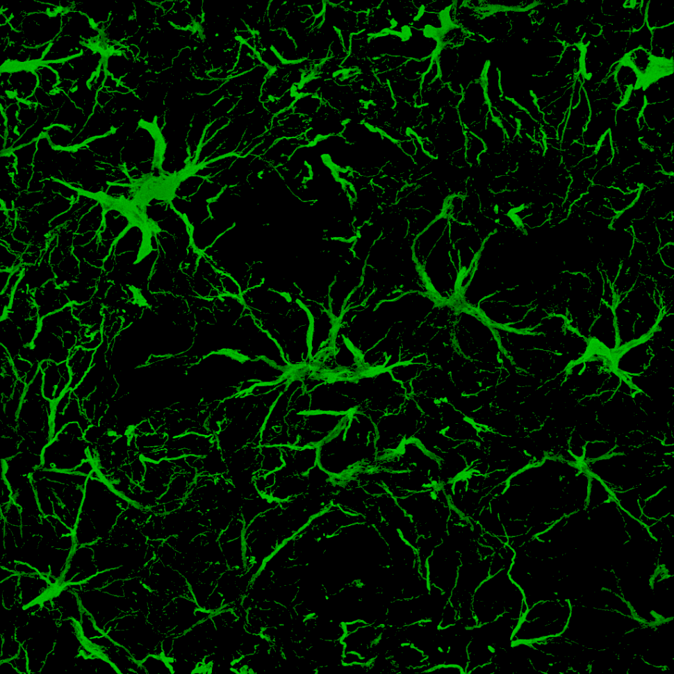 Astrocyte (Gfap) and Microglia (Iba1) staining in PFA-fixed mouse brain ...